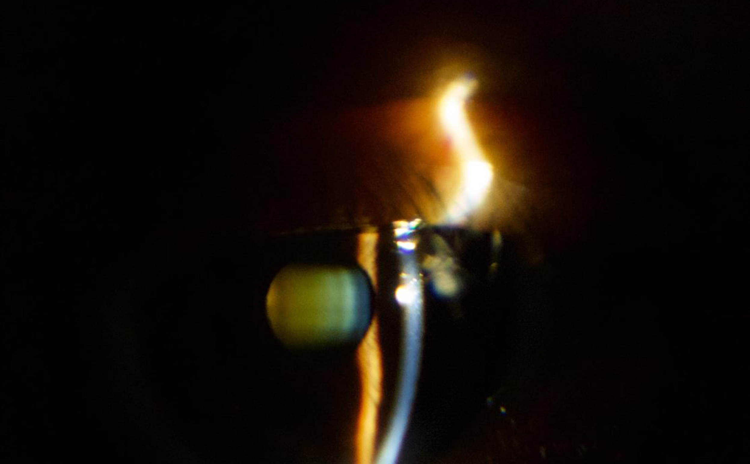 Remidio PSL D20 | Hand Held Portable Slit Lamp